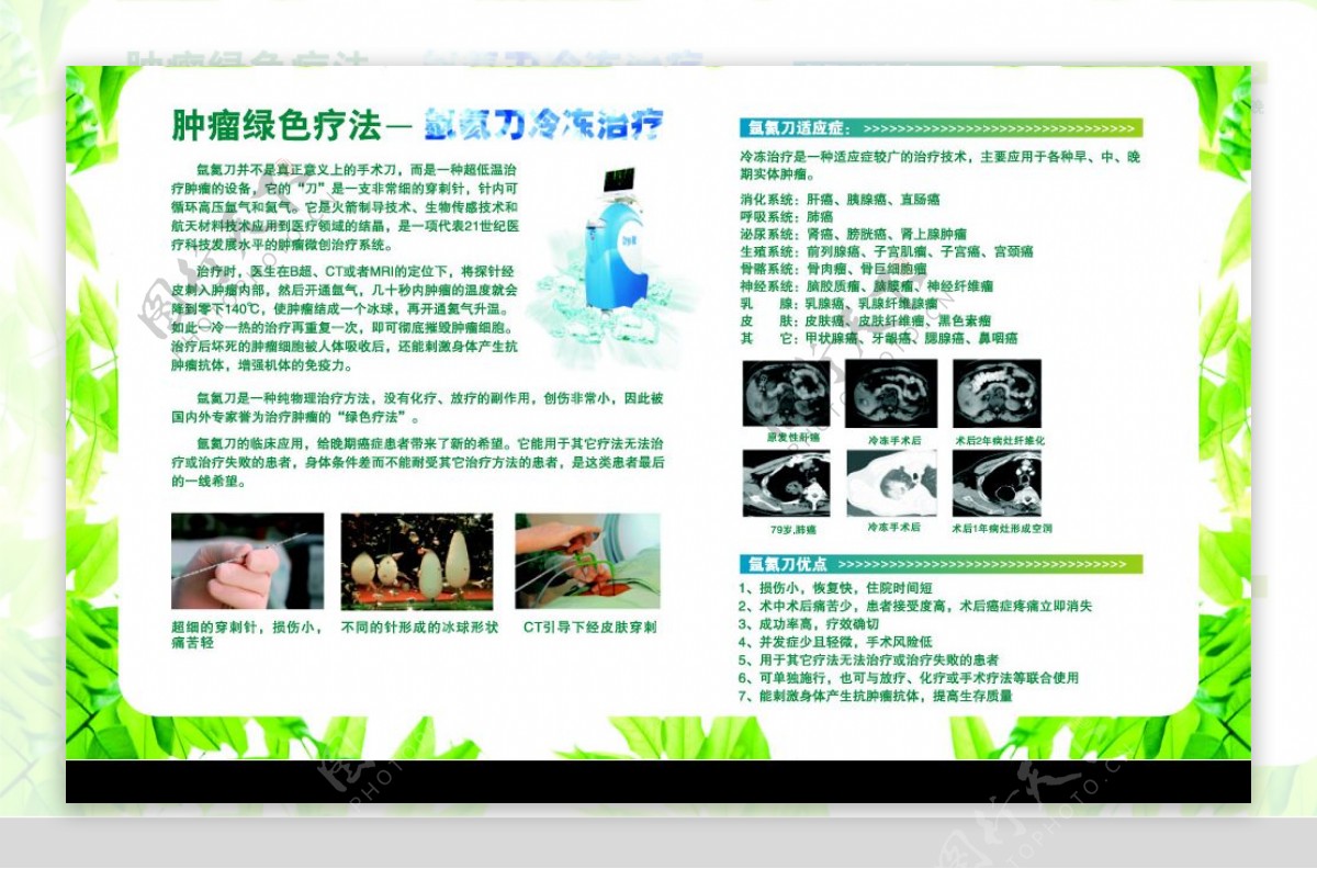 医院肿瘤绿色疗法氩氦刀冷冻治疗图片素材-编号28154013-图行天下
